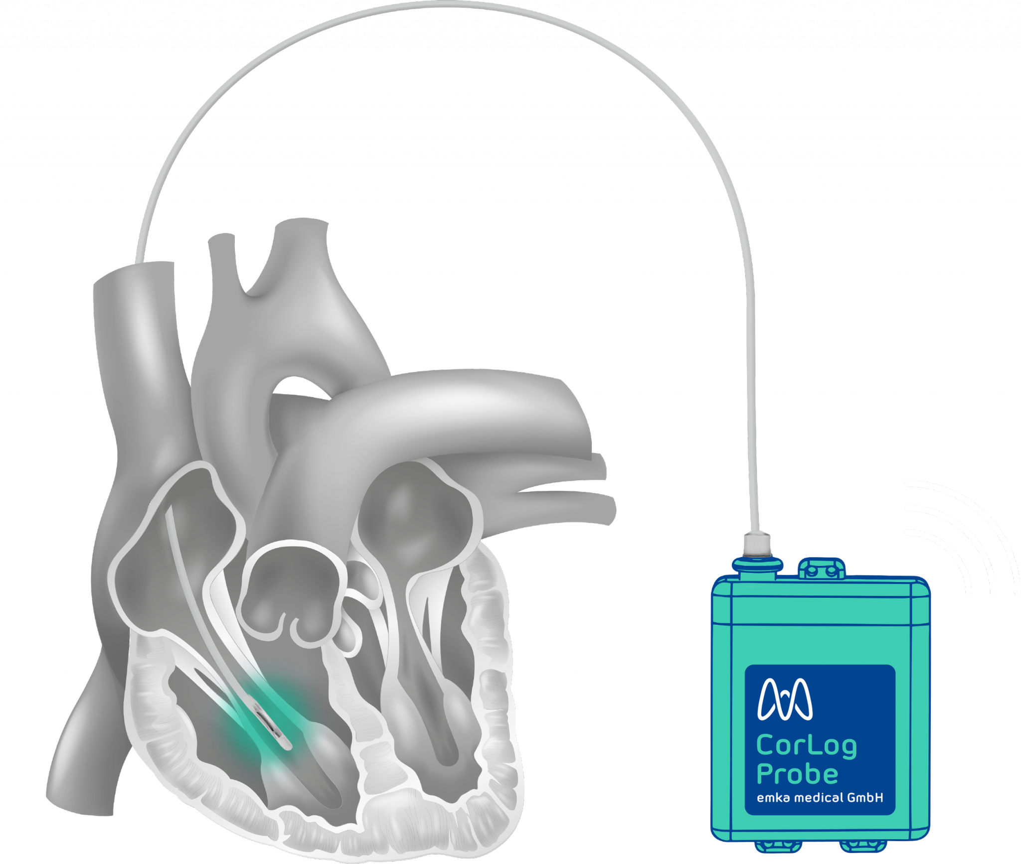 emka medical GmbH - Monitoring solutions for heart failure: CorLog