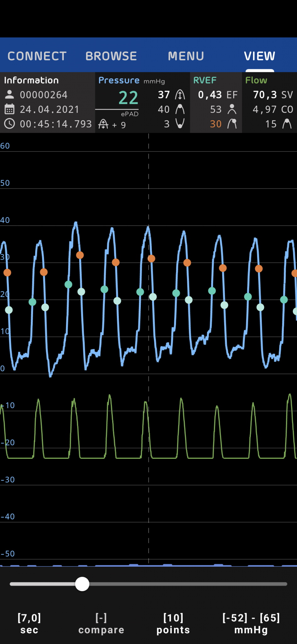 CorLog and cardiac output - emka medical GmbH